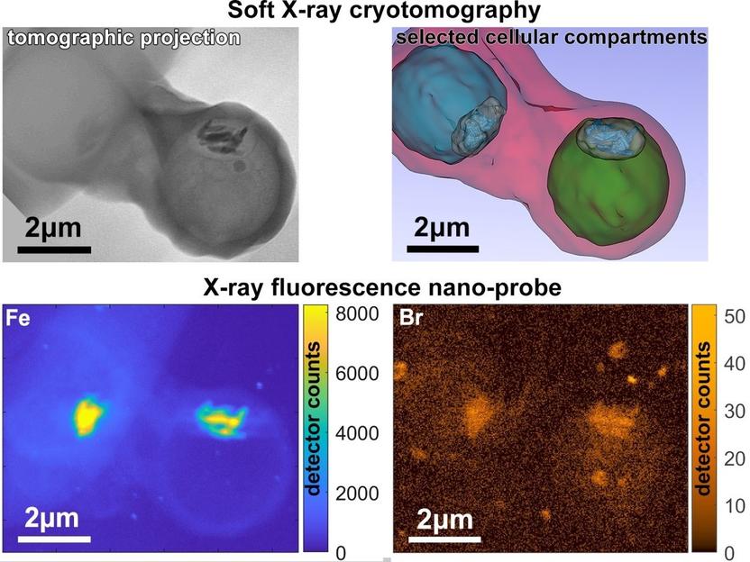 Malaria pathogens under the X-ray microscope