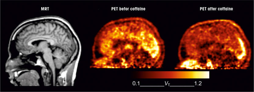 Caffeine Kick - - How it affects the human brain