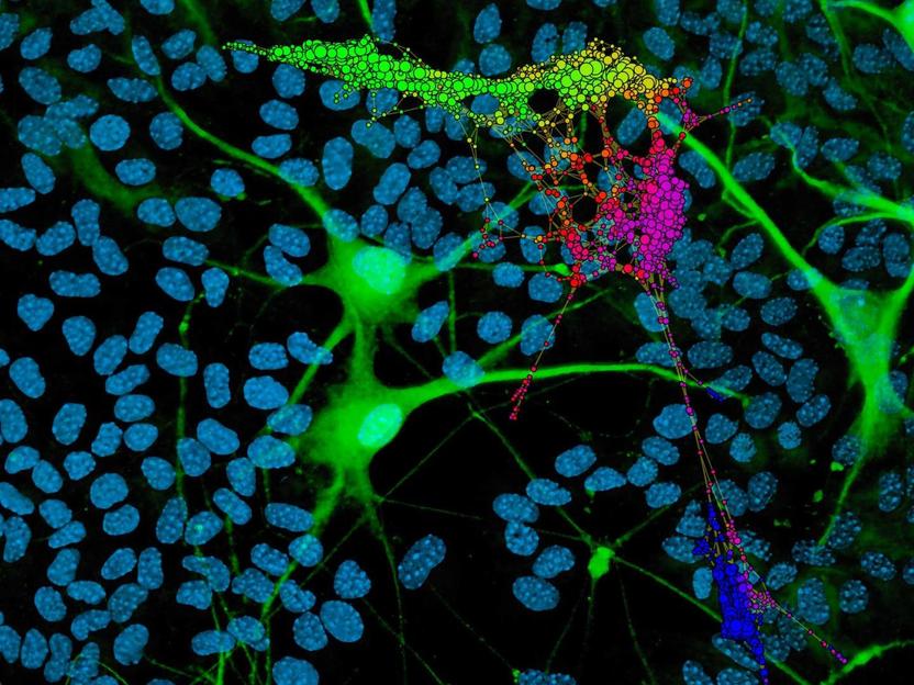Initiative taps scientists to create atlas of cells in human spinal cord
